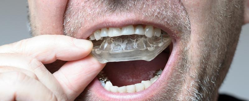 Some people who grind their teeth when they sleep apply up to 250 ...