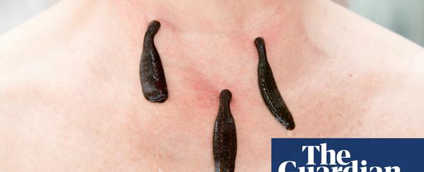 Leeches have 32 brains | The Fact Base