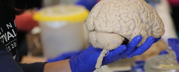 The average human brain contains around 78 water | The Fact Base