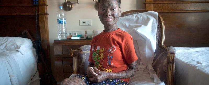 Humans shed 3 6 kg 8 lbs of dead skin each year | The Fact Base