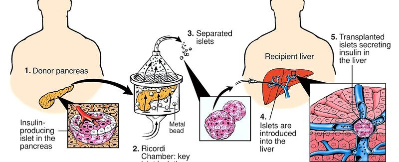 The pancreas produces insulin | The Fact Base
