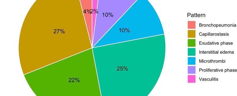 A delicious way of presenting numbers piechart | The Fact Base