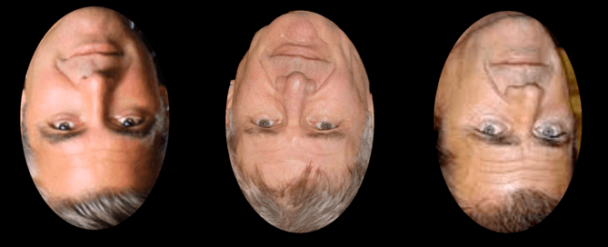 Prosopagnosia also known as face blindness means you cannot recognize ...