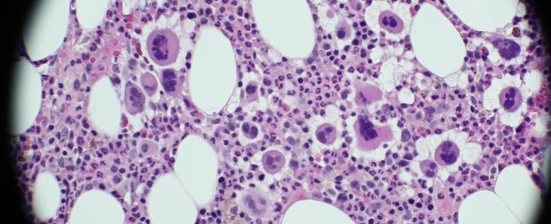 In humans the bone marrow is the fastest growing tissue followed by ...