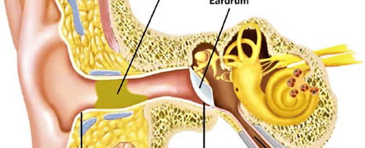 Earwax is a type of sweat made by the ceruminous glands a specialized ...